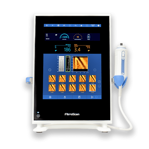 FibroScan® - Scienty-Med