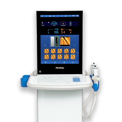 FibroScan® - Scienty-Med