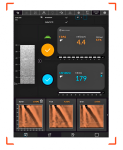 FibroScan® - Scienty-Med